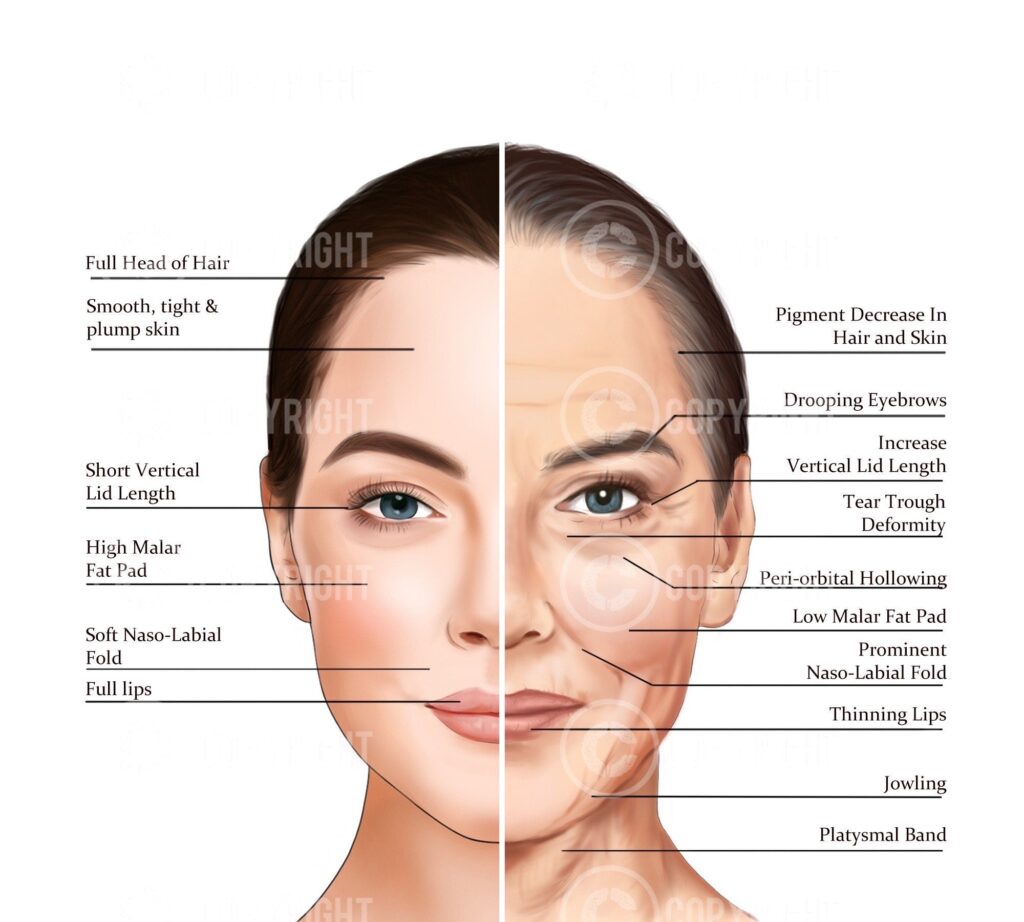Ageing of the Face and Neck | Anatomy | Poster | Aesthetics ...