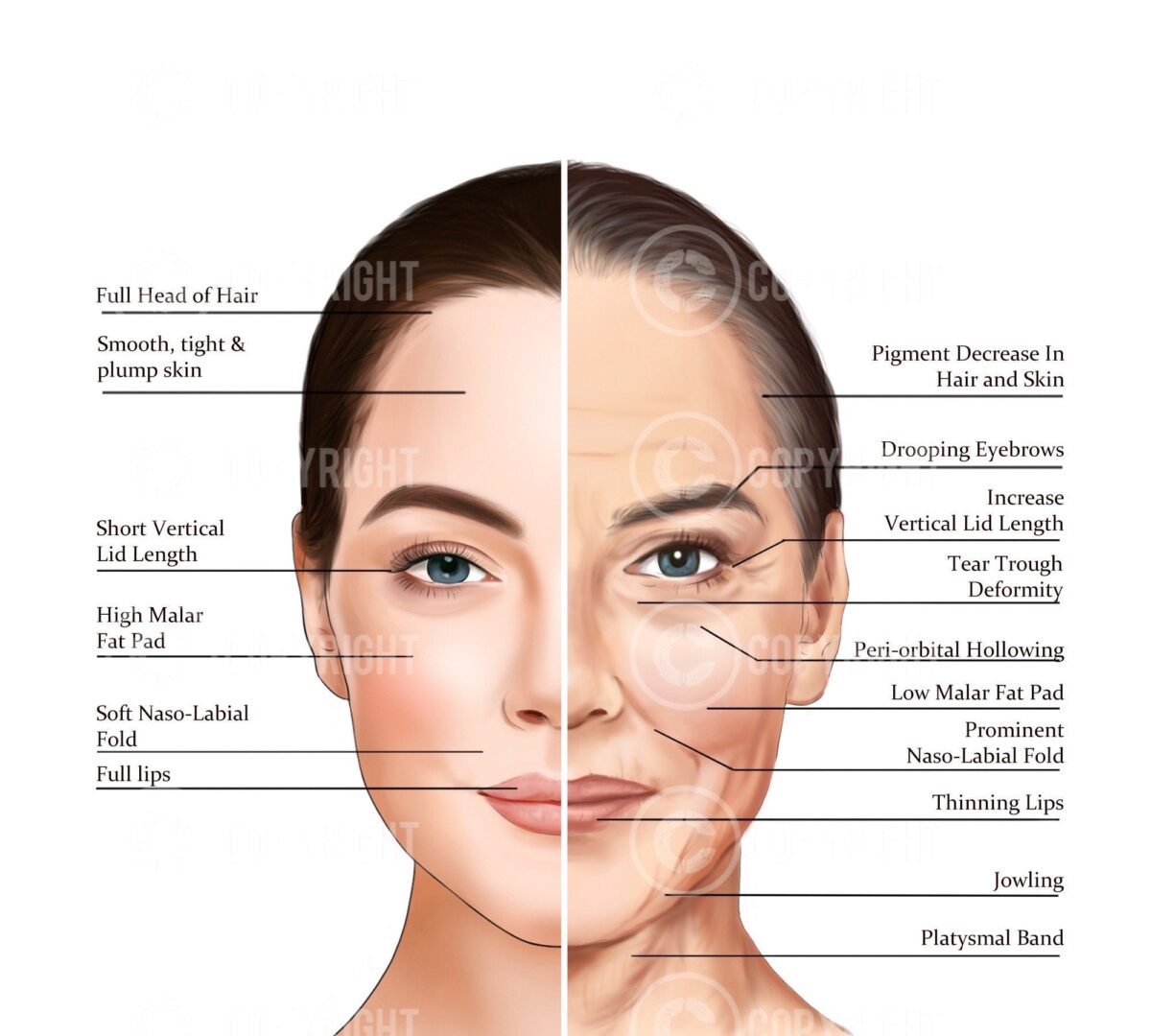 Ageing of the Face and Neck | Anatomy | Poster | Aesthetics ...